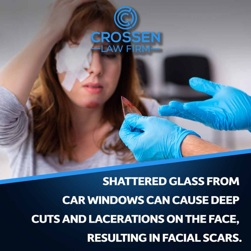 Facial Scars from a Car Accident | Crossen Law Firm