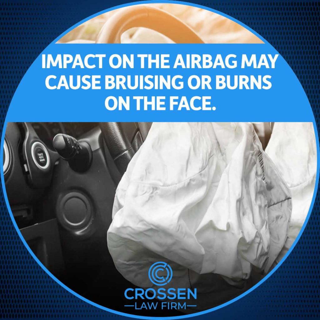 Facial Scars from a Car Accident | Crossen Law Firm
